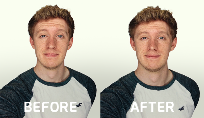 Vox Thinks Lens Distortion From Selfies Are to Blame for Nose Job Trend ...