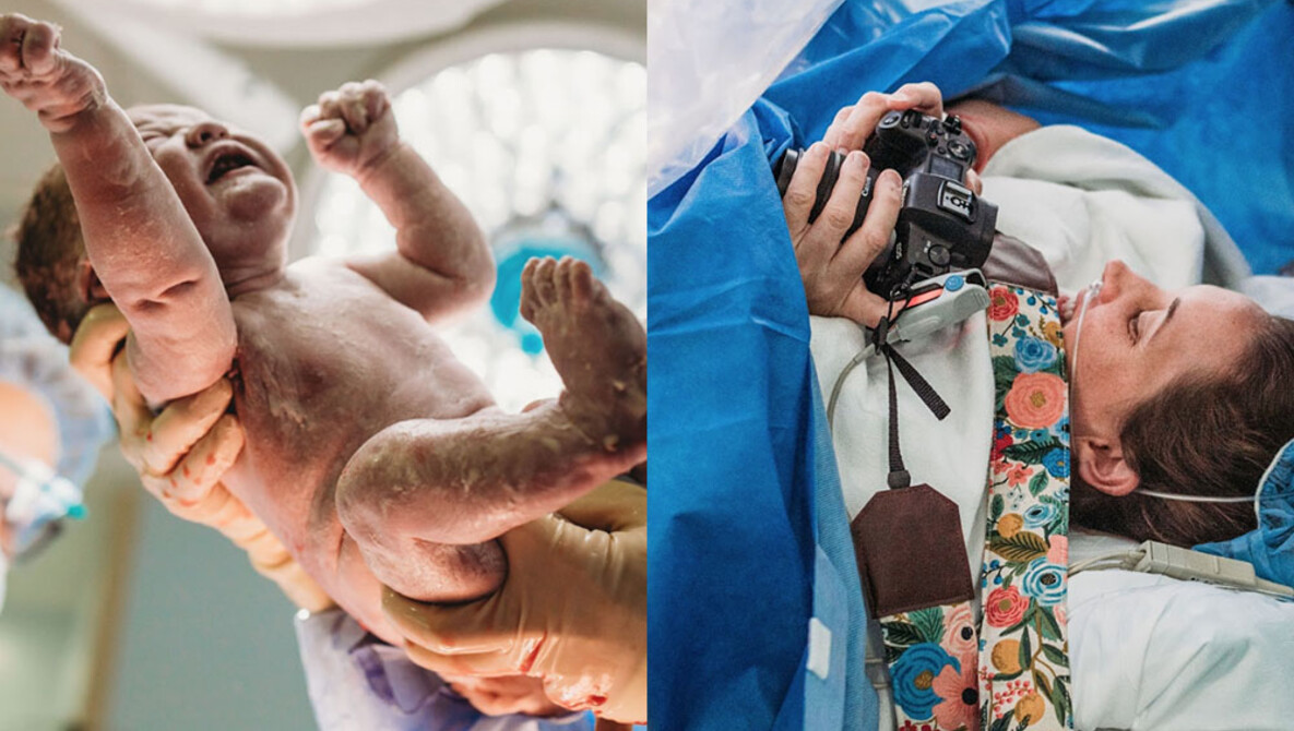 Photographer Takes Pictures Throughout Her C-Section to Document Her ...